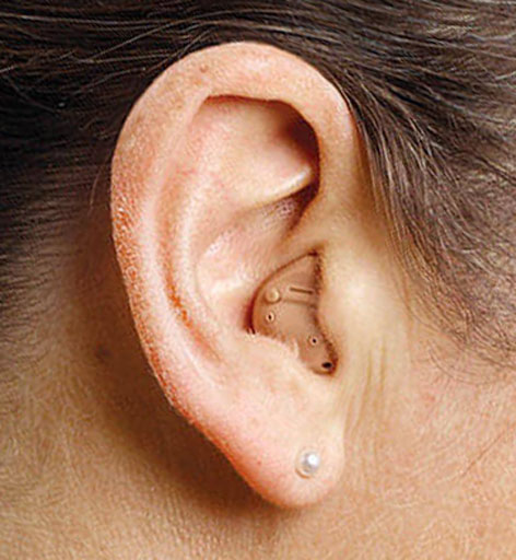 Audífonos y prótesis auditivas - Centro profesional de Audiología AETEK